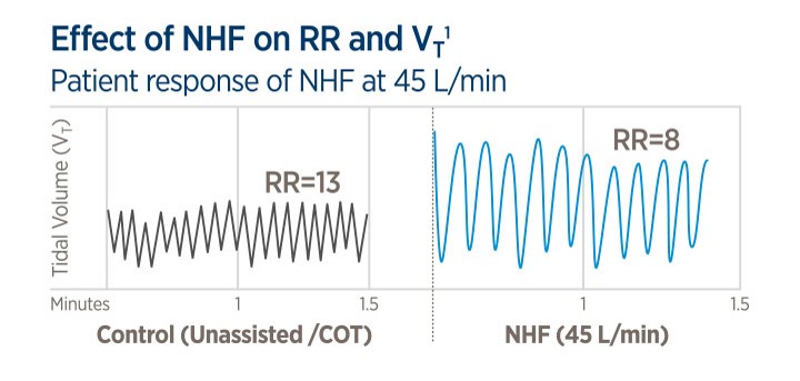 Optiflow™ Nasal High Flow therapy [5 key Mechanisms of Action] | Fisher ...