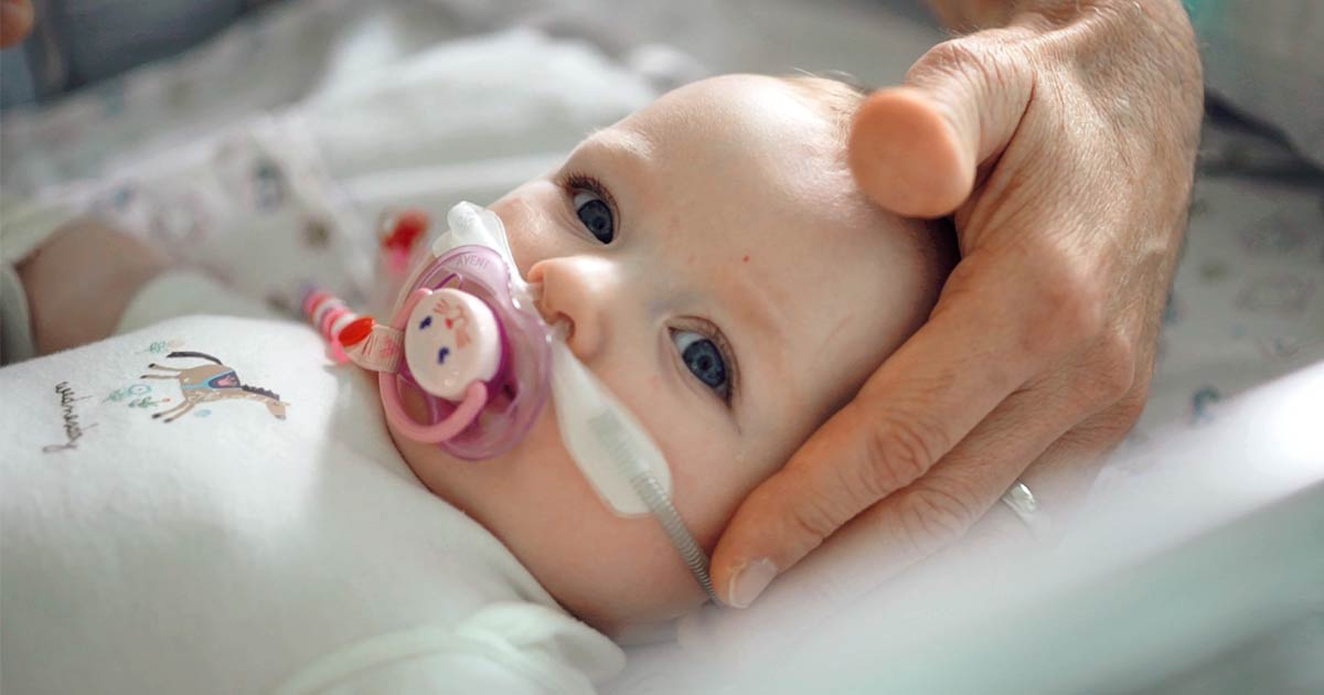 Ground Breaking Research Shows Efficacy of Optiflow™ Nasal High Flow ...