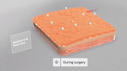 Effects of Cold Dry CO2 | Fisher & Paykel Healthcare
